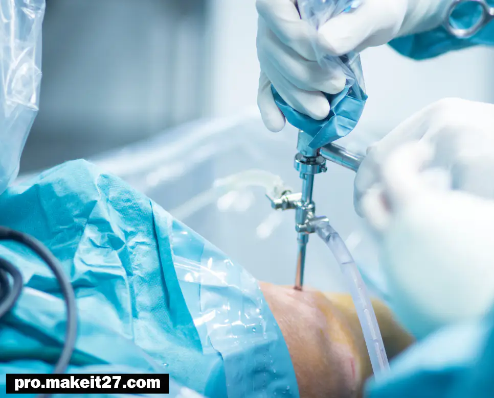 STEMI 의학용어, OS 의학용어, PTBD 의학용어 - pro27